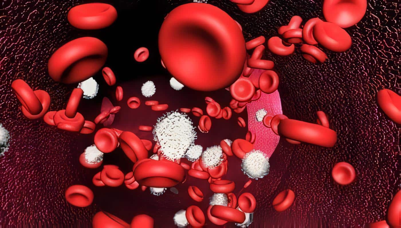 Anemia Por Deficiencia De Hierro, Enfermedad Crónica