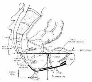 La Vía Posterior en el Tratamiento de las Lesiones del Recto