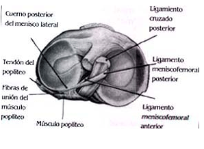 MENISCO DISCOIDE INTERNO, REVISTA DE ORTOPEDIA, VOL. 13 No. 2