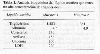 Ascitis Quilosa, Revista De Cirugía, Medicina, Salud