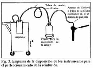 Autotransfusión, Revista De Cirugía, Medicina, Salud