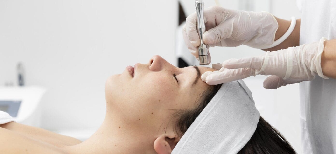 Microdermoabrasión, Beneficios Microdermoabrasión