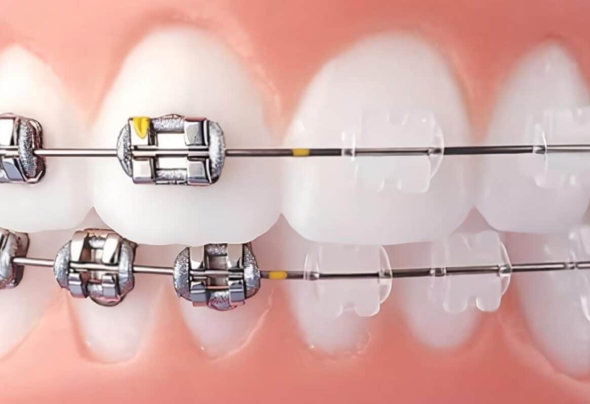 Guías Básicas De Protocolo Clínico En Operatoria Dental