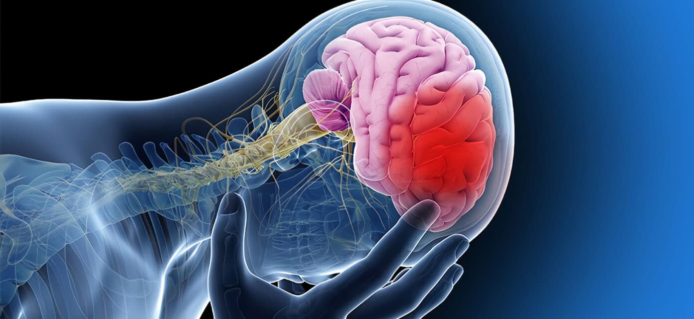ACV: Síntomas y tratamientos - Enfermedades y Guías de Salud