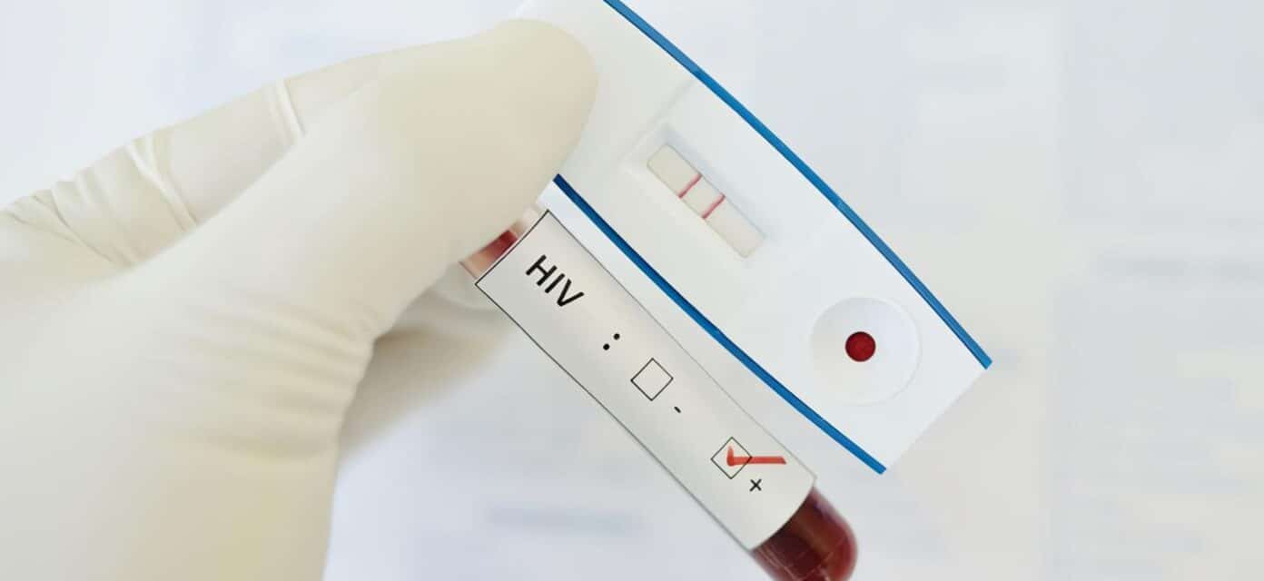 Señales que indican que debes hacerte un Examen de ETS